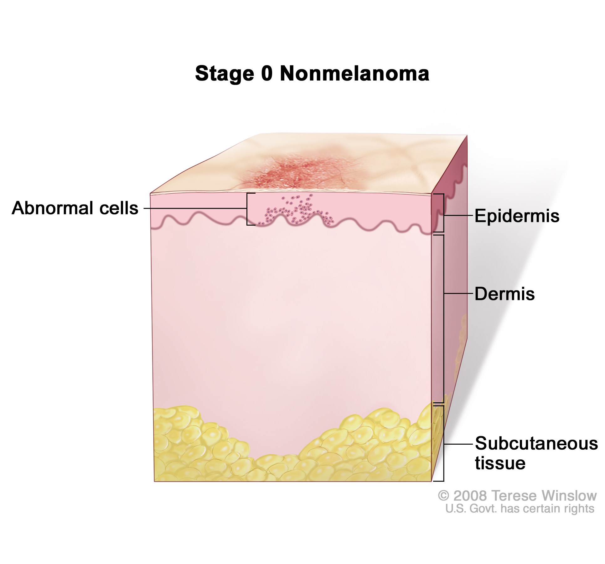 Subcutaneous Tissue Cells