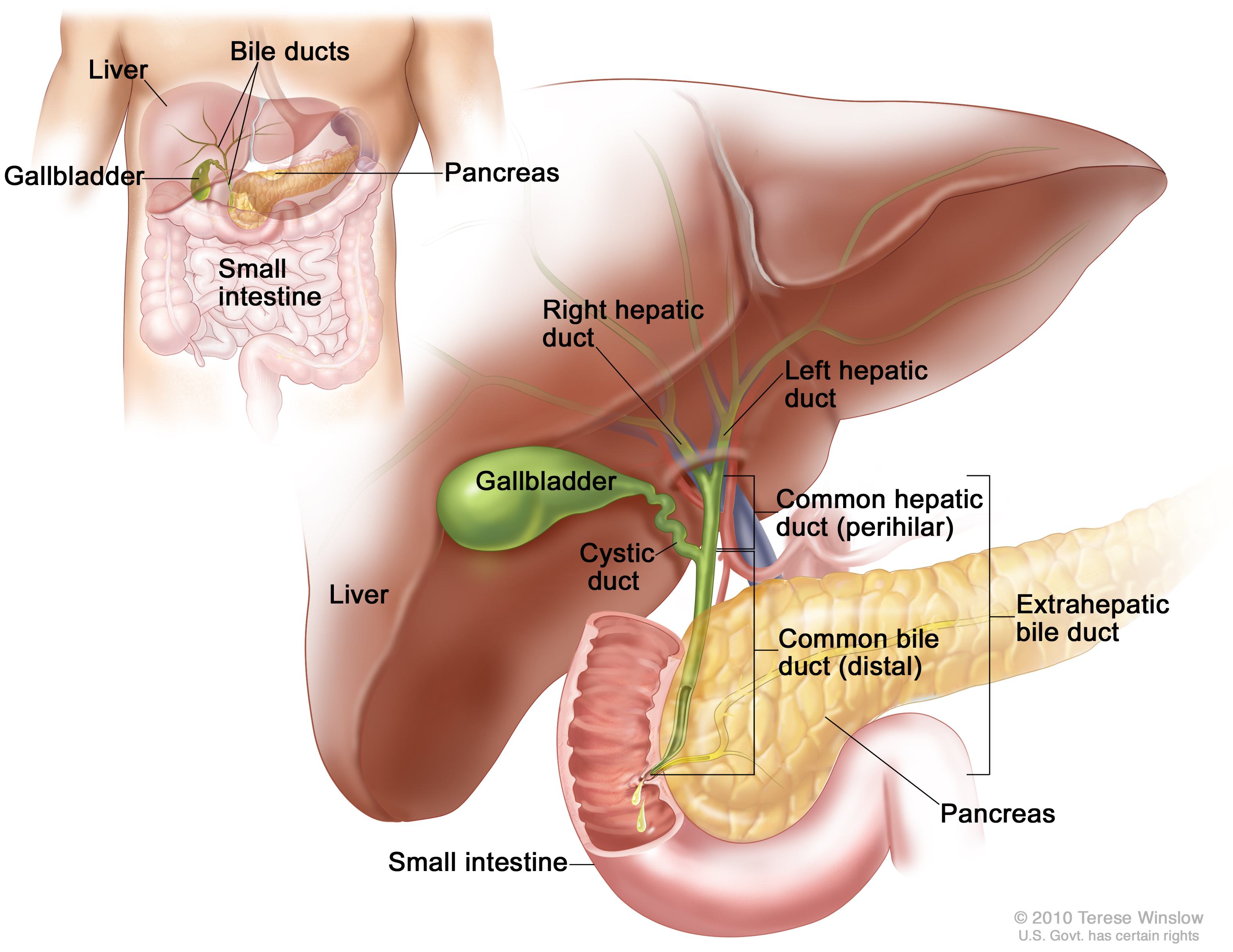Extrahepatic Bile Duct Cancer Treatment PDQ Cure Today